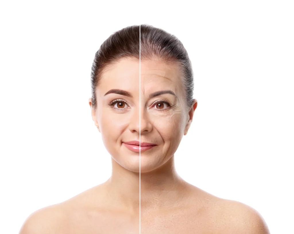 FaceTite Treatment - Albury Wodonga